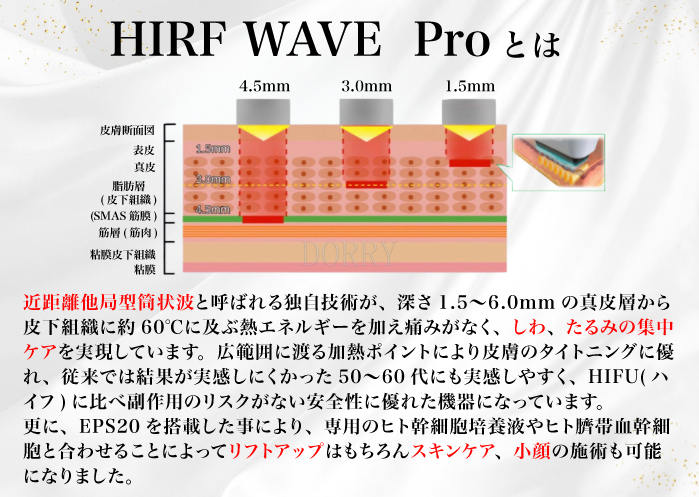 HIRF WAVE SERIES (ハイアールエフウェーブ) シワ・たるみ集中ケアマシン | 株式会社Dorry